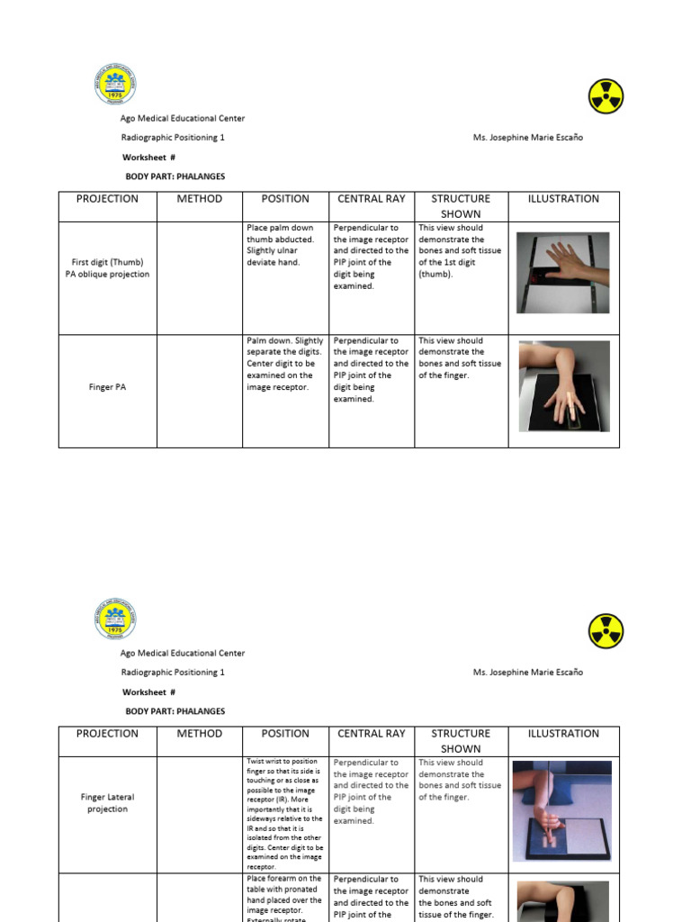 Projection Method Position Central Ray Structure Shown Illustration ...