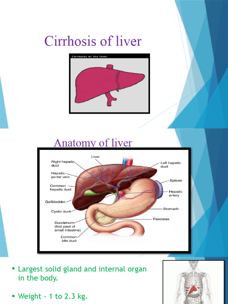 Presentation on Cirrhosis of Liver | PDF | Liver | Cirrhosis