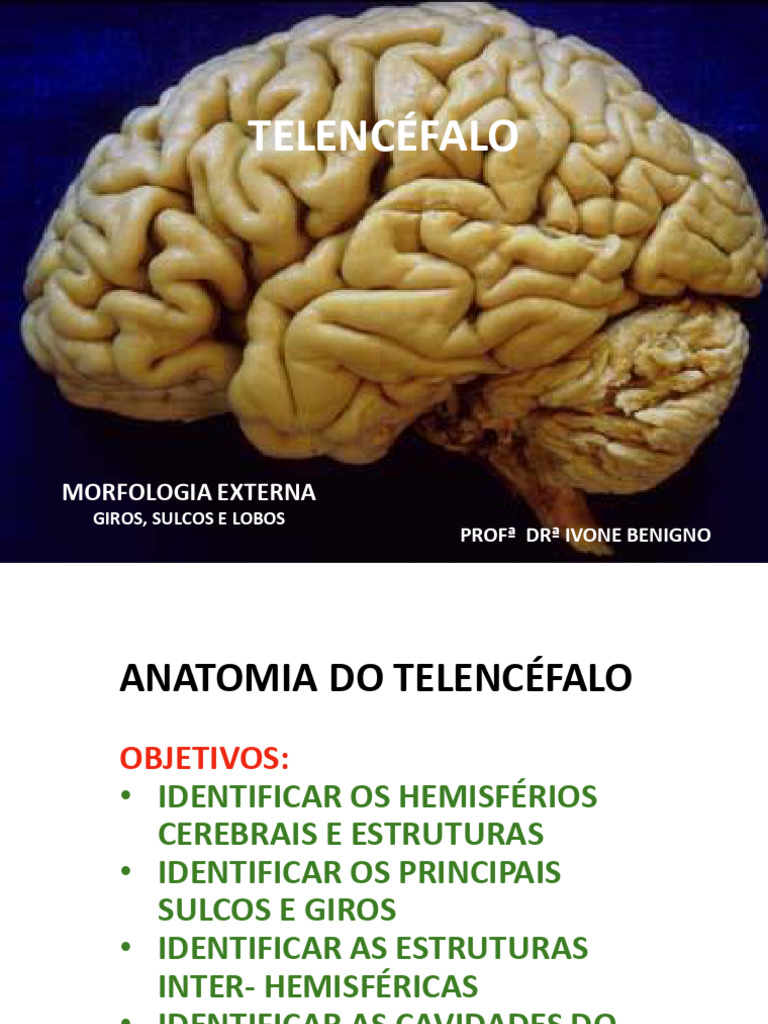 Anatomia do Telencéfalo e Estruturas | PDF | Telencéfalo | Anatomia humana