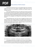Panoramic Radiograph Interpretation Guide | PDF | Dental Anatomy ...