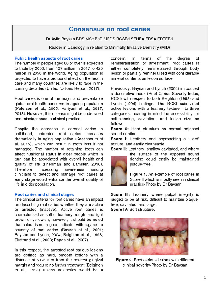 ORCA - Consensus On Root Caries - Baysan - 24 - June - 2022 | PDF ...