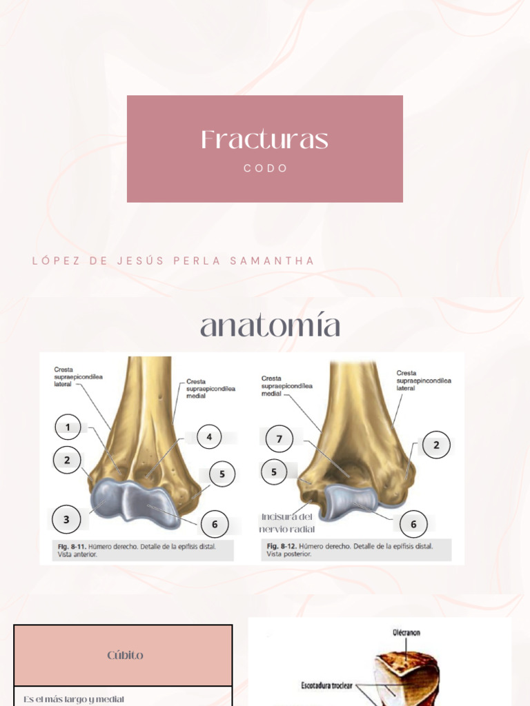Clasificación y Tratamiento de Fracturas de Codo | PDF | Codo ...