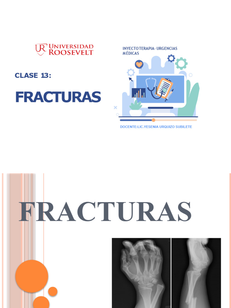 Fracturas | PDF | Hueso | Mano