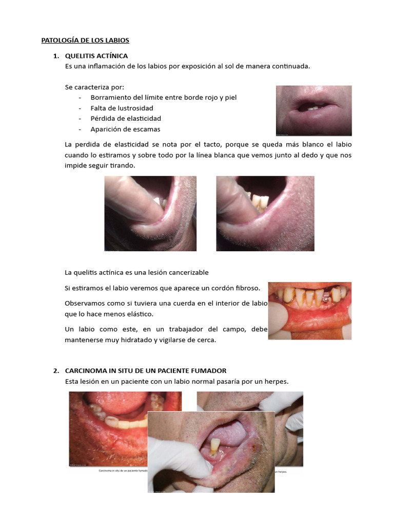 Patología del labio y de la lengua | PDF | Gusto | Las bacterias