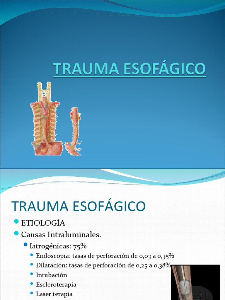 14 - TRAUMA ESOFÁGICO | PDF | Emergencias Médicas | Traumatologia