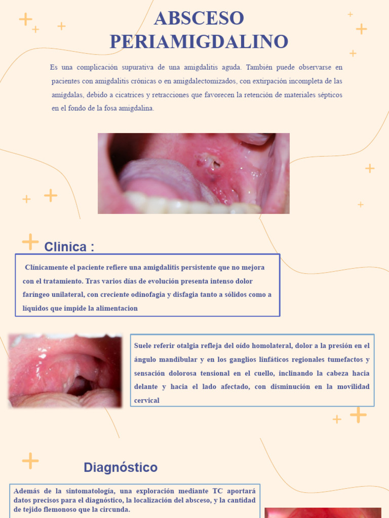 Abscesos Periamigdalino | PDF | Causas de la muerte | Medicina