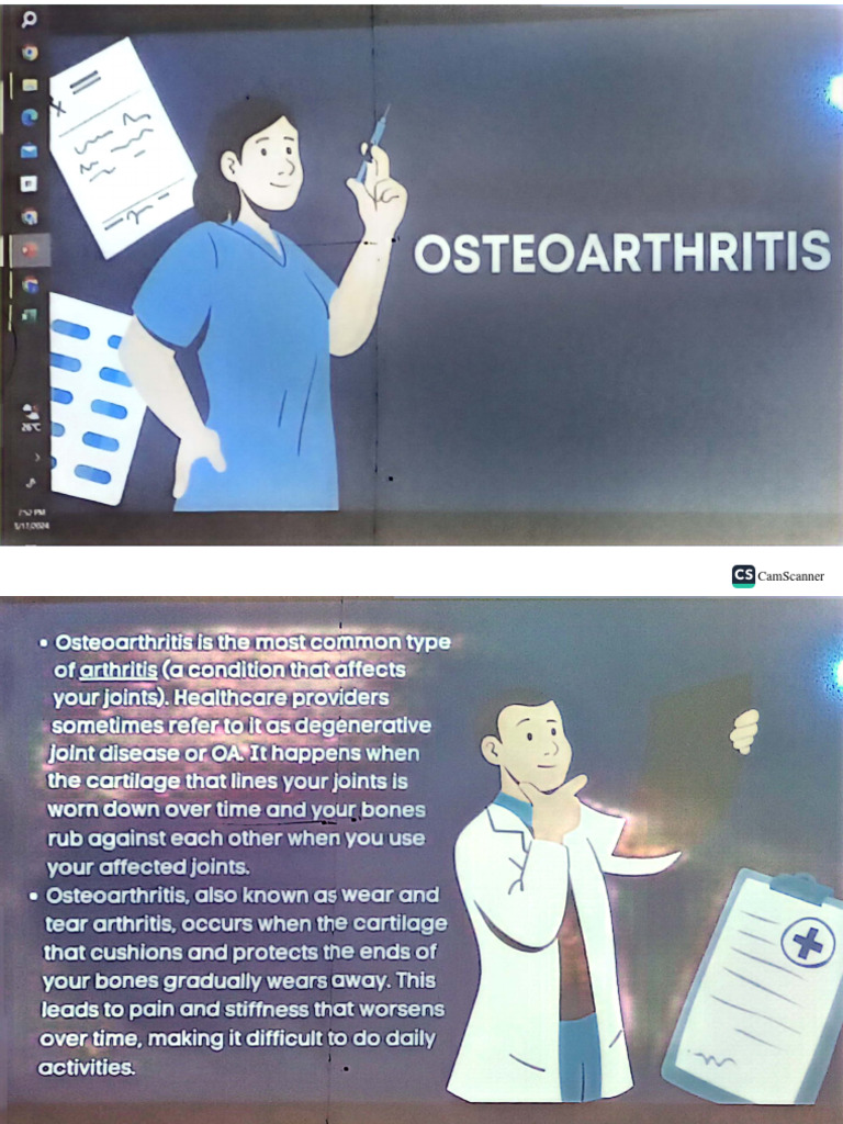 Oa Cts LBP Do Si MVV | PDF