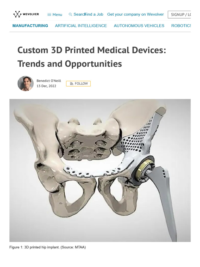 Custom 3D Printed Medical Devices - Trends and Opportunities | Download ...