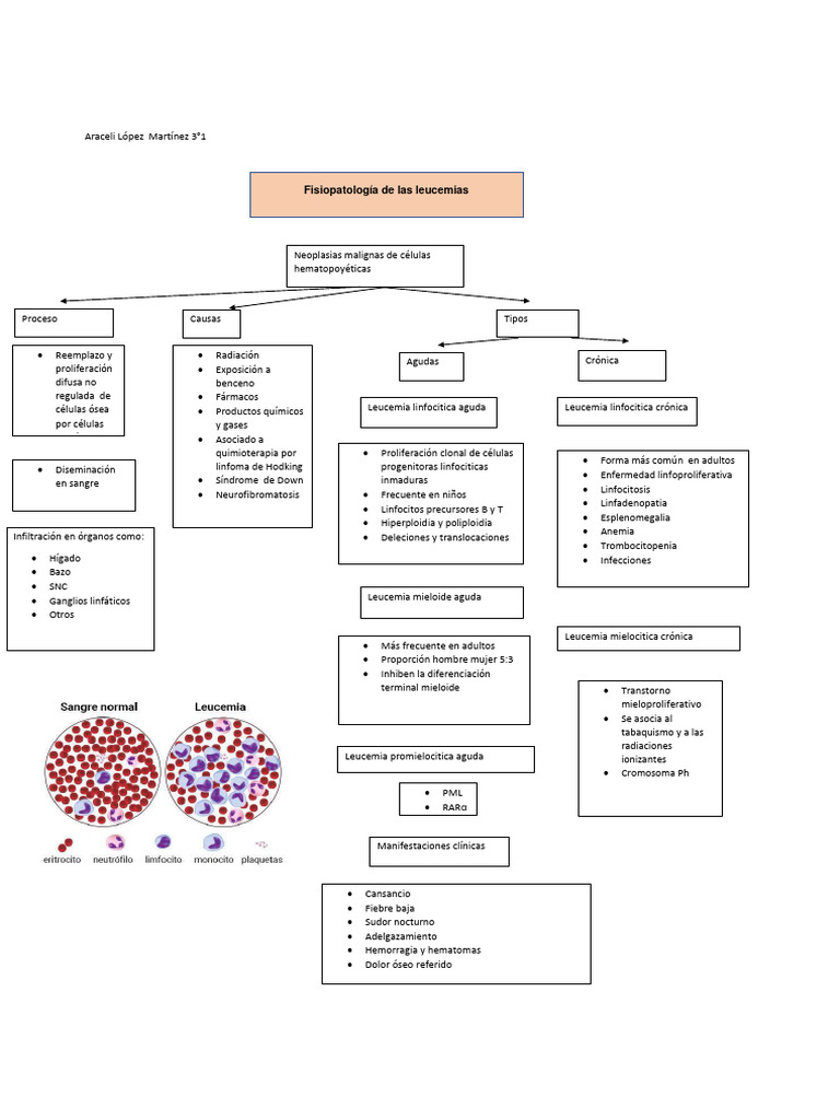 Leucemias | PDF | Leucemia | Medicina CLINICA