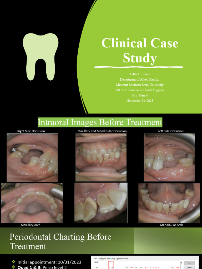 Dental Hygiene Case Study Overview | PDF | Dieting | Periodontology