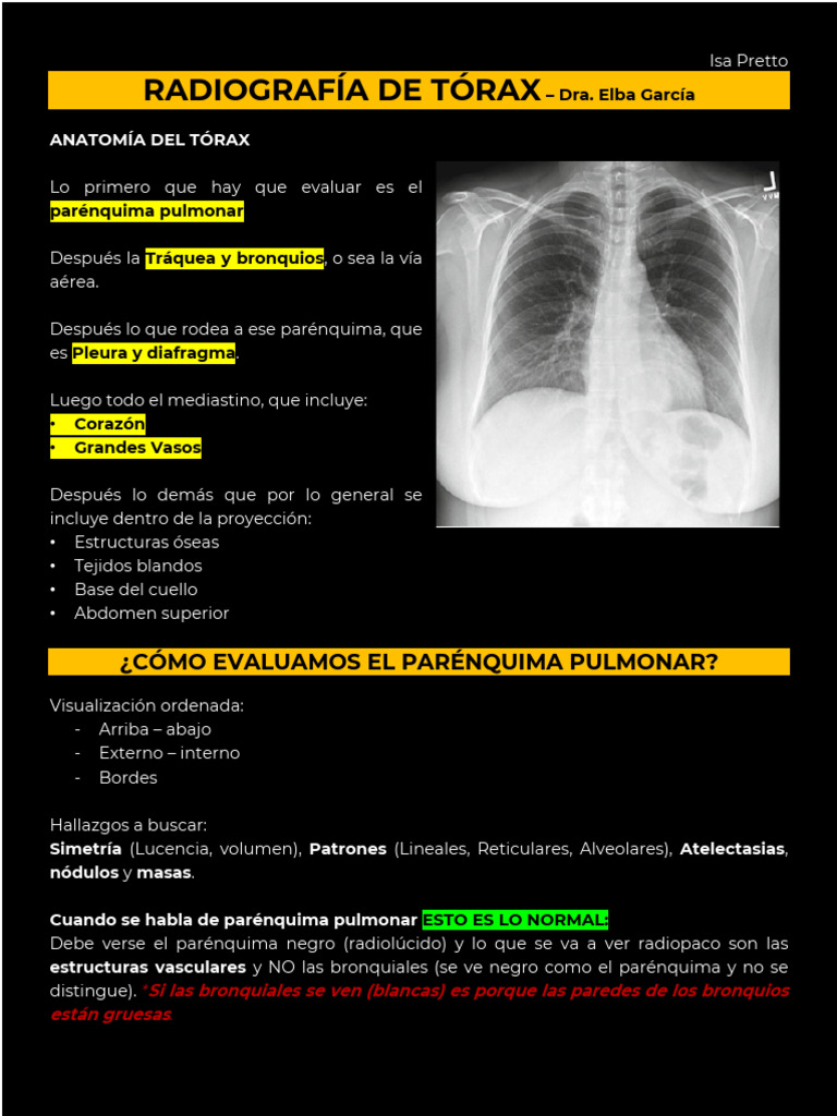Rx tórax | PDF | Pulmón | Aorta