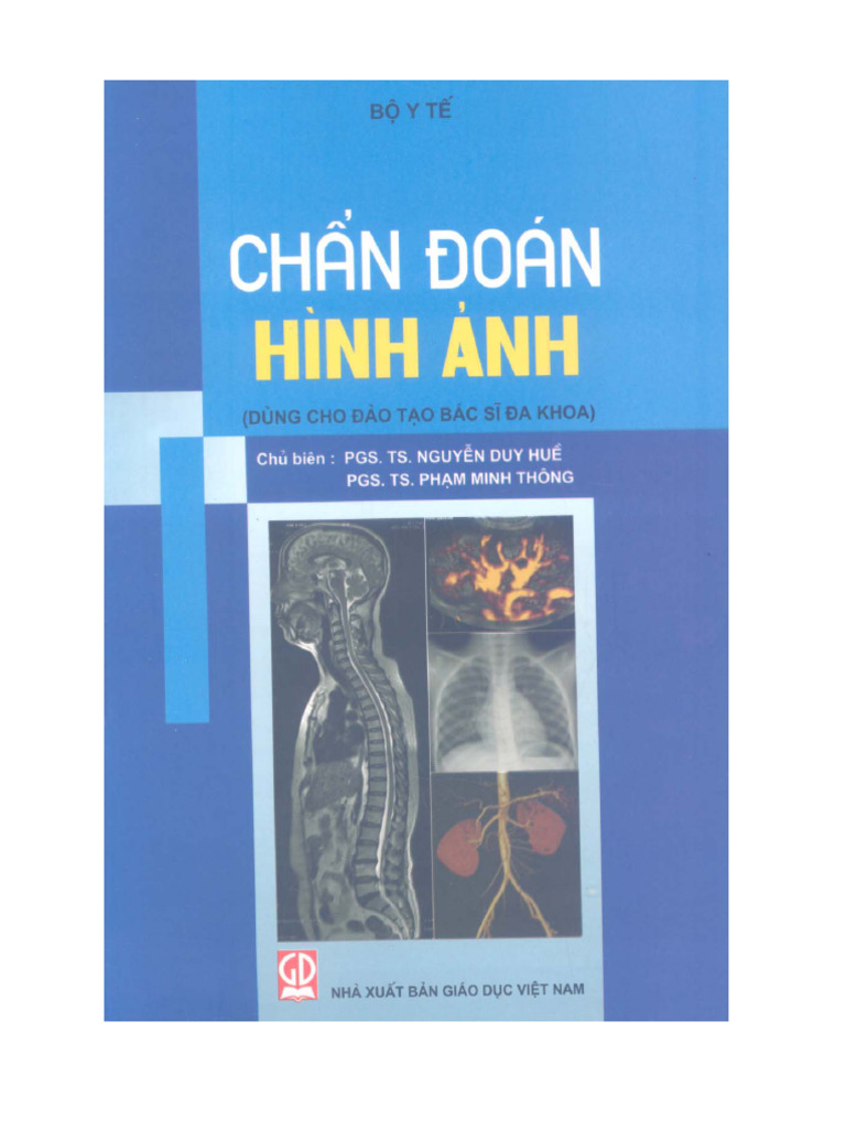 CDHA - Chan Doan Hinh Anh (BSDK), PGS Nguyen Duy Hue, PGS Pham Minh Thong | PDF