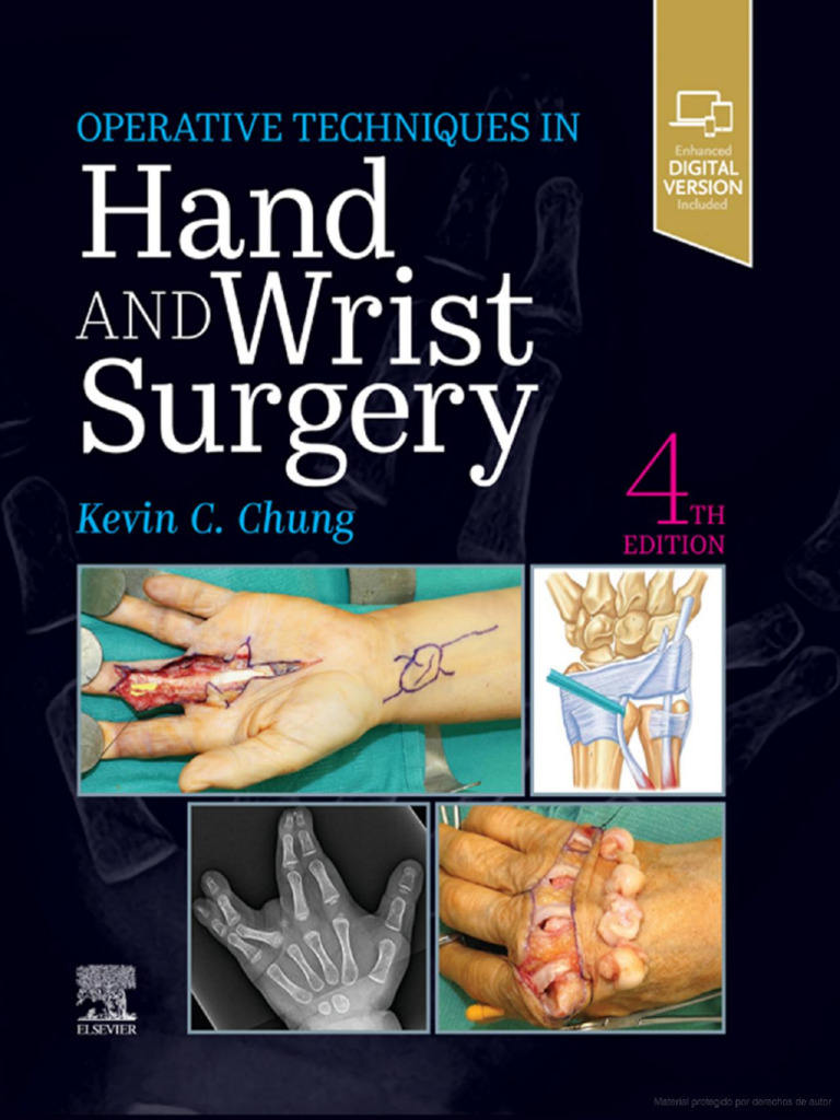 Kevin C. Chung MD MS - Operative Techniques - Hand and Wrist Surgery ...