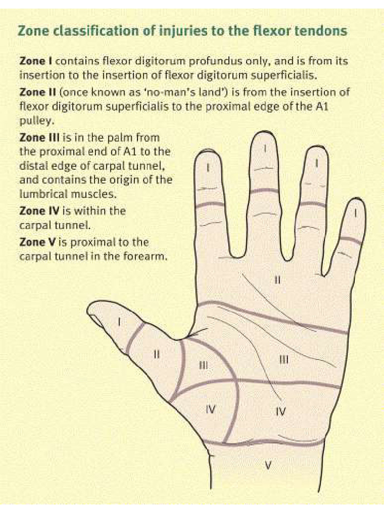 Hand Zones1 | PDF
