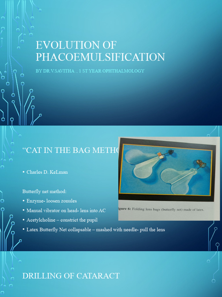 Phacoemulsification Techniques | PDF | Social Science | Wellness