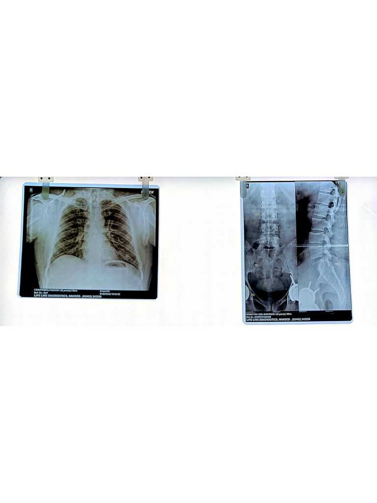 Xrays | PDF