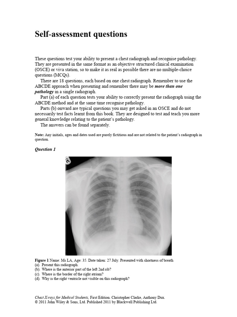Chest X-ray Pathology OSCE Prep | PDF | Radiography | Multiple Choice