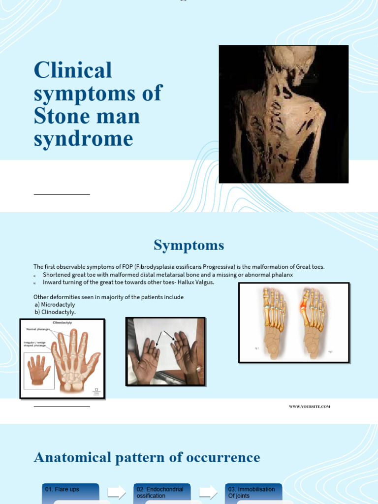 Stone Man Syndrome (Shini) | PDF | Toe | Vertebral Column