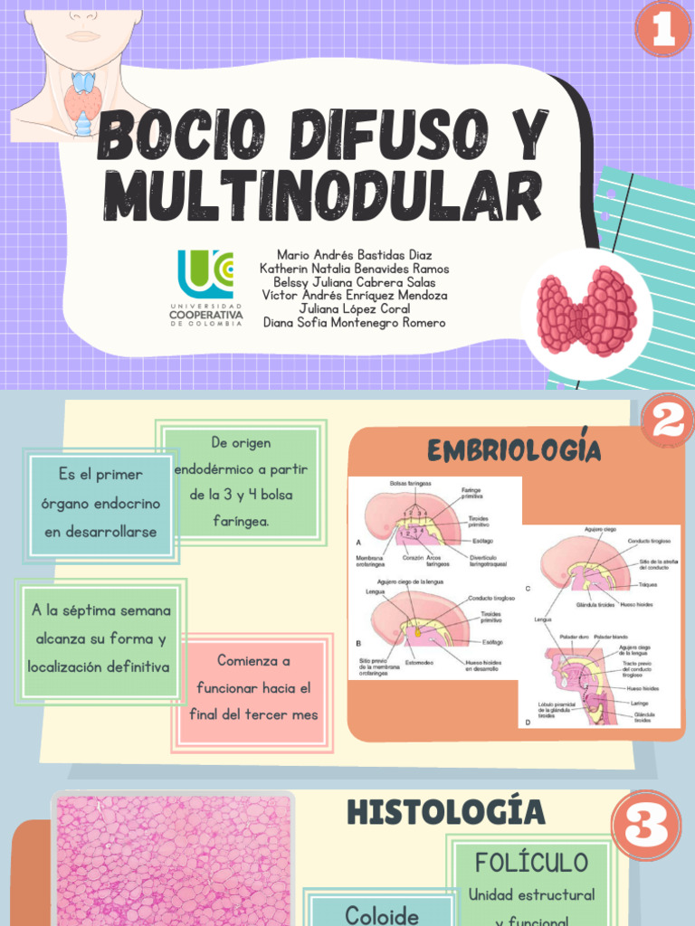 Bocio Difuso y Multinodular | Descargar gratis PDF | Tiroides | Hormona ...