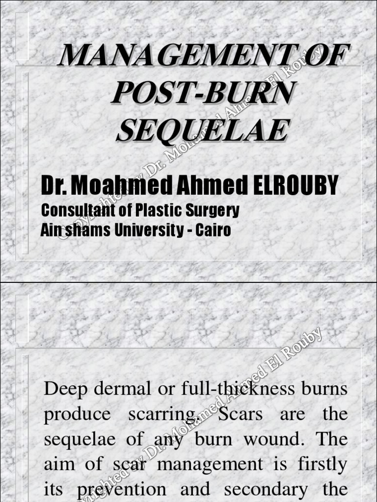 Management of Post Burn Sequelae | PDF | Scar | Finger