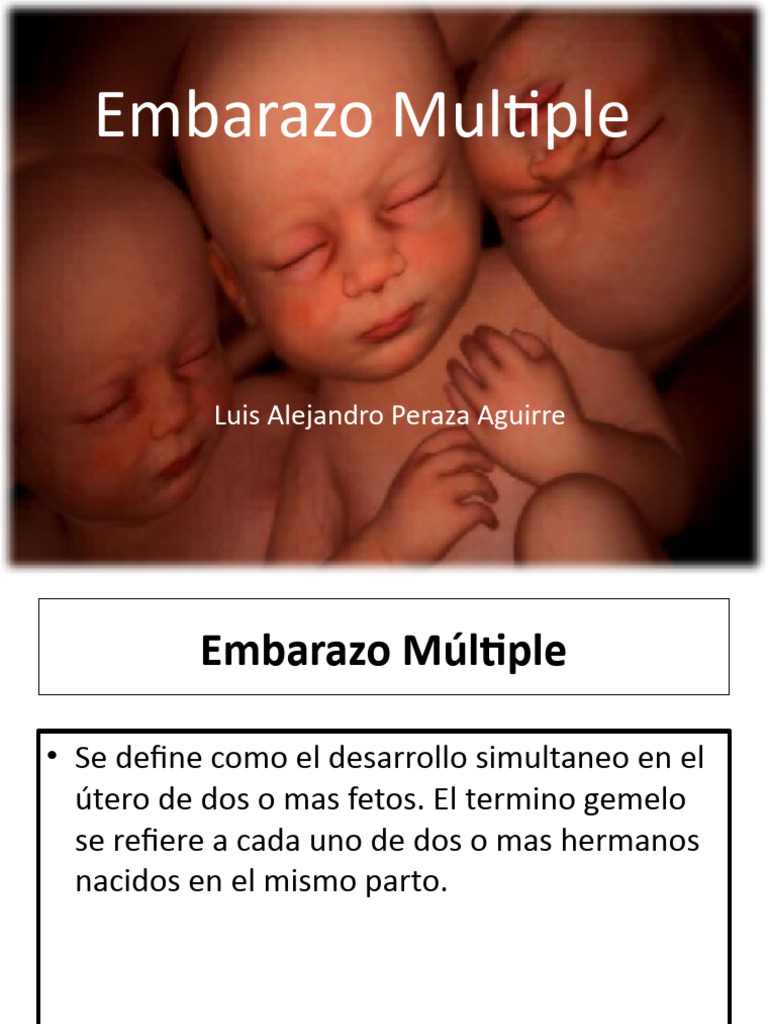 Embarazo Múltiple: Definición y Tipos | PDF | El embarazo | Parto