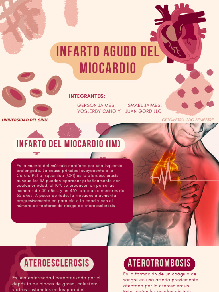 Causas y tipos de infarto al miocardio | PDF | Infarto de miocardio ...