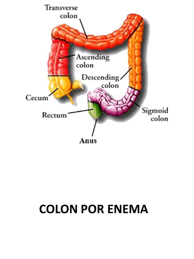 Colon | Intestino grueso | Enfermedad de Crohn