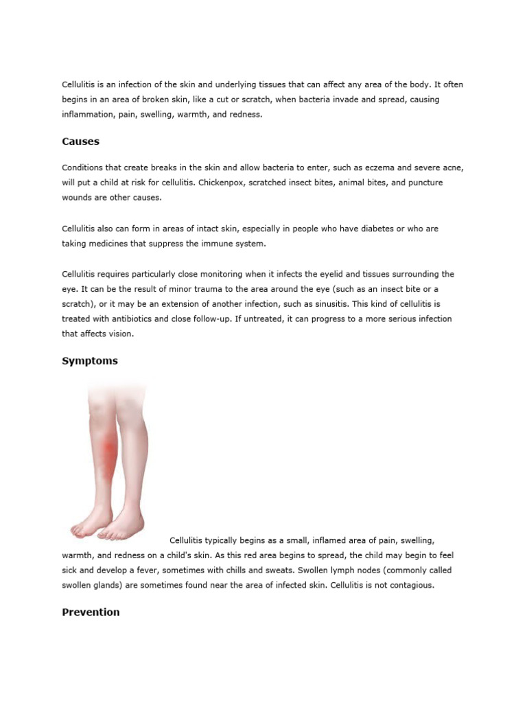 Cellulitis | PDF | Intravenous Therapy | Infection