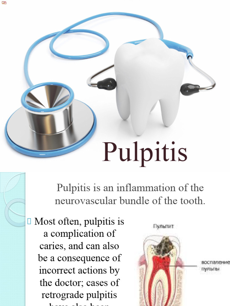 Understanding Retrograde Pulpitis | PDF | Causes Of Death | Dental Anatomy