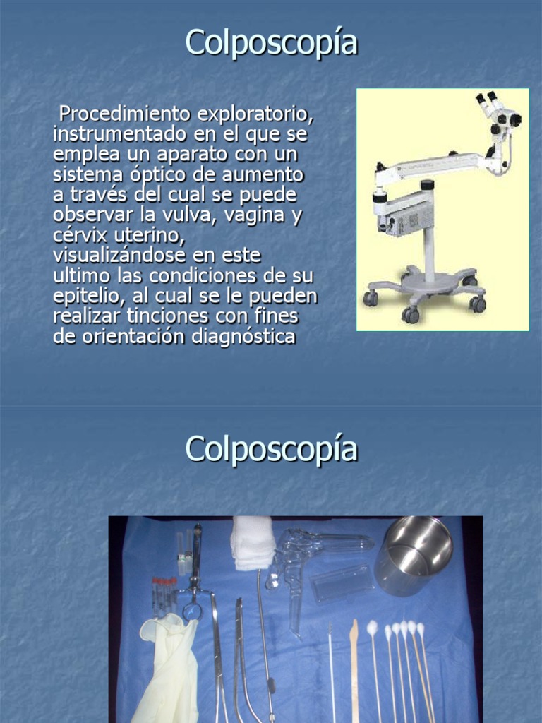 Colposcopía | PDF | Vagina | Epitelio