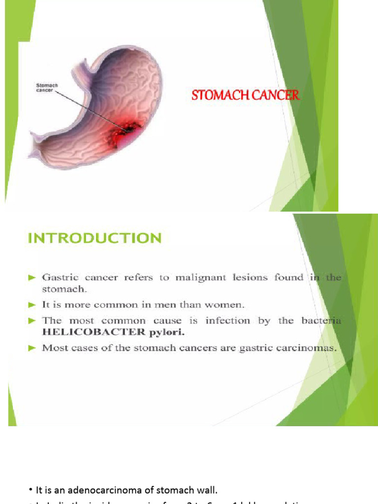 Stomach Cancer: Pathophysiology & Management | PDF