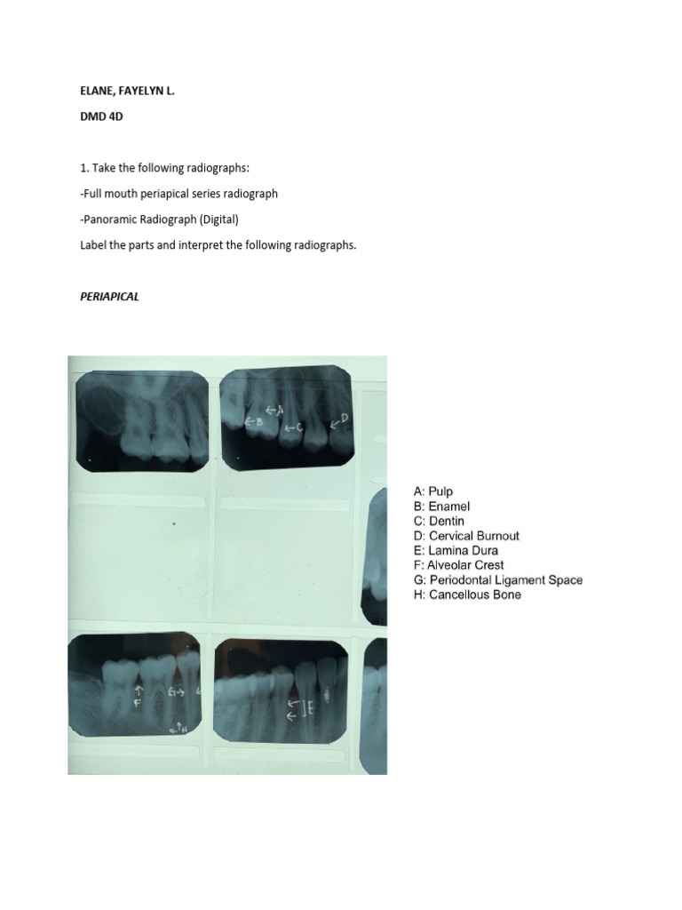 Perio m3 Post Task | PDF | Periodontology | Tooth Enamel