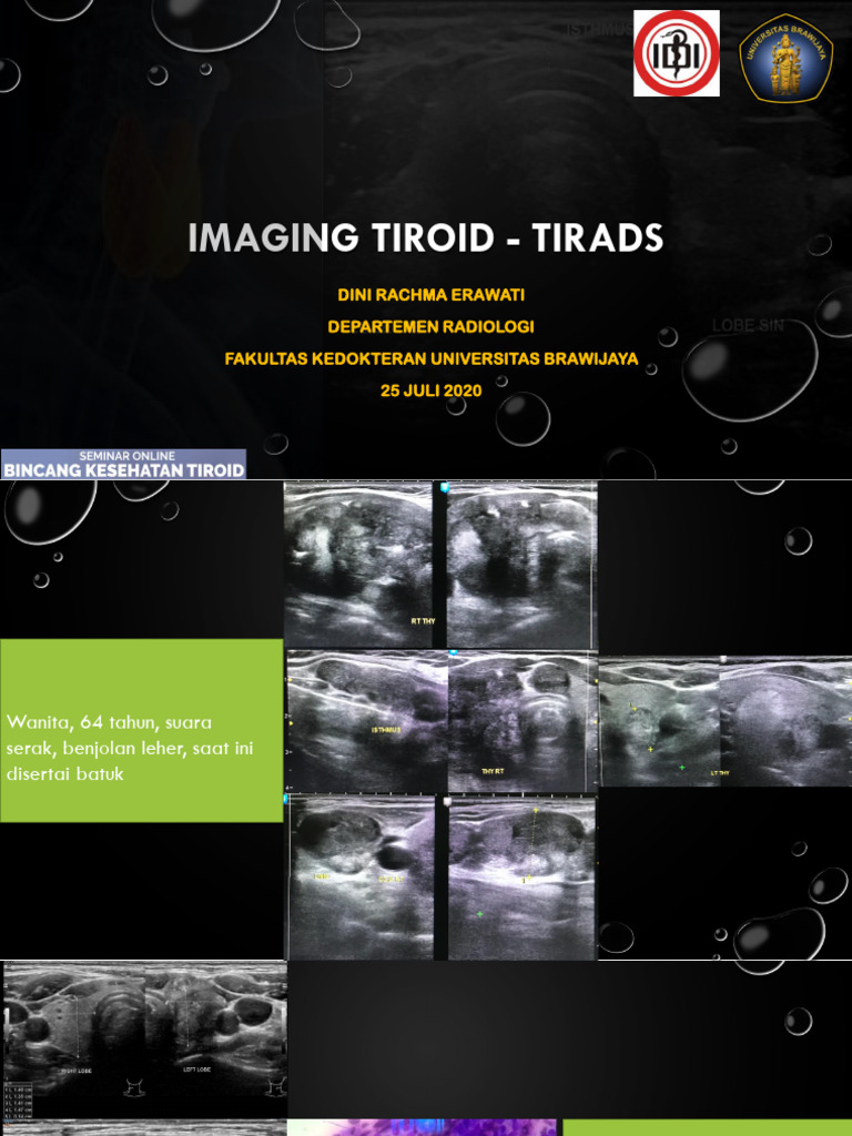 Materi 3 - Imejing Tiroid - TIRADS | PDF