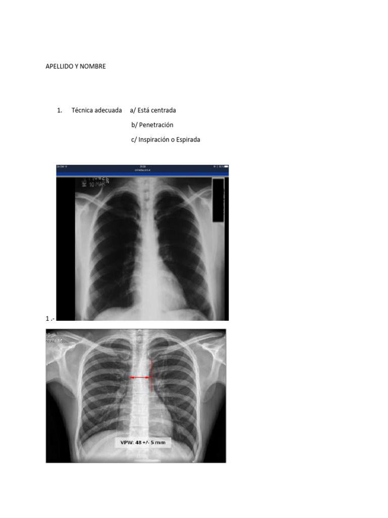 RX Torax Tecnica y Topografia Trabajo 2024 | PDF | Historia