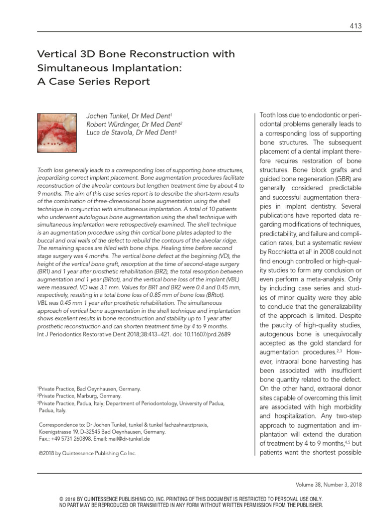 Vertical 3D Bone Reconstruction With Simultaneous Implantation A Case ...
