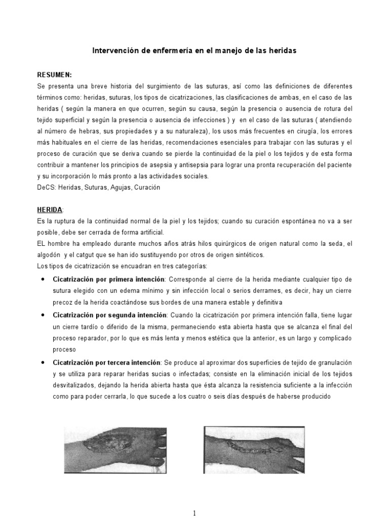 Intervención de Enfermería en El Manejo de Las Heridas | PDF | Herida | Especialidades Medicas