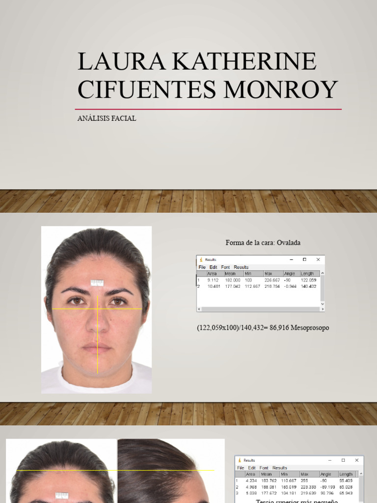 Analisis Facial | PDF | Cabeza y cuello humanos | Rasgos faciales