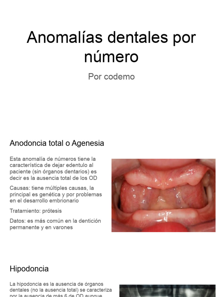 Anomalias Dentales Por Numero | PDF | Diente | Ramas de Odontología