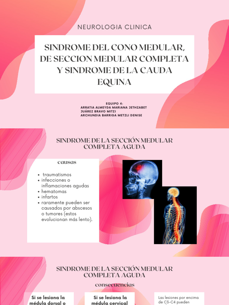 SINDROME DEL CONO MEDULAR, DE SECCION MEDULAR COMPLETA y SINDROME DE LA CAU - 20240416 - 081434 ...