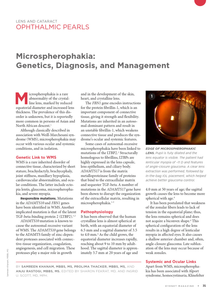 March 2019 Ophthalmic Pearls | PDF | Glaucoma | Myopia