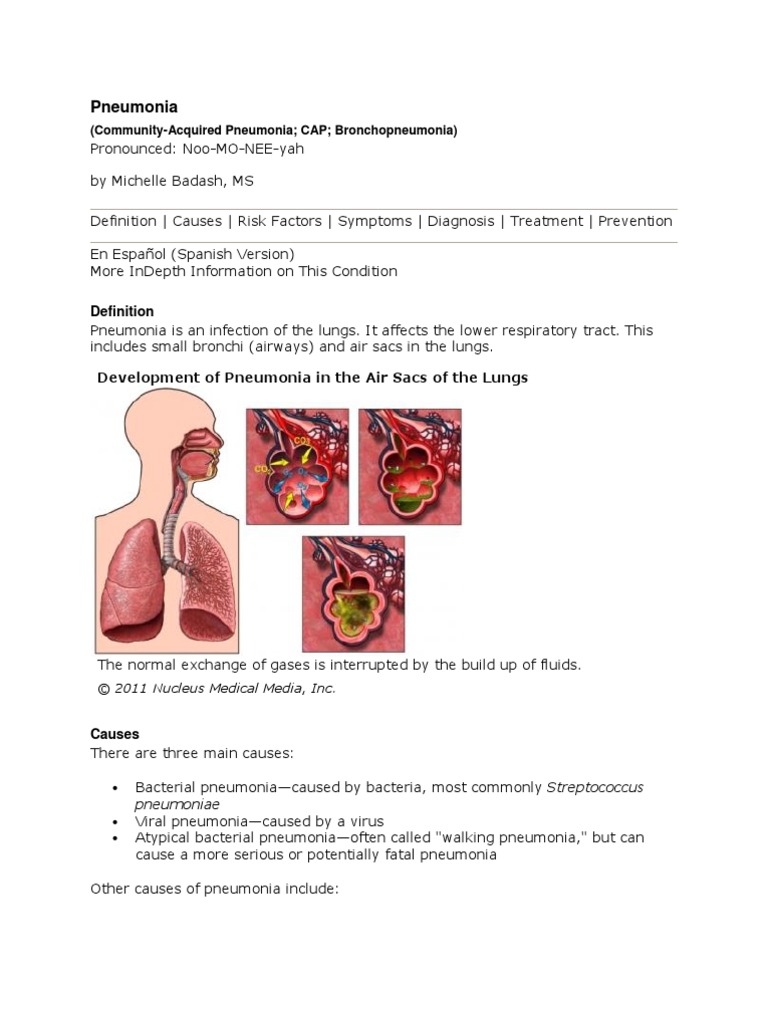 Pneumonia | PDF | Pneumonia | Infection