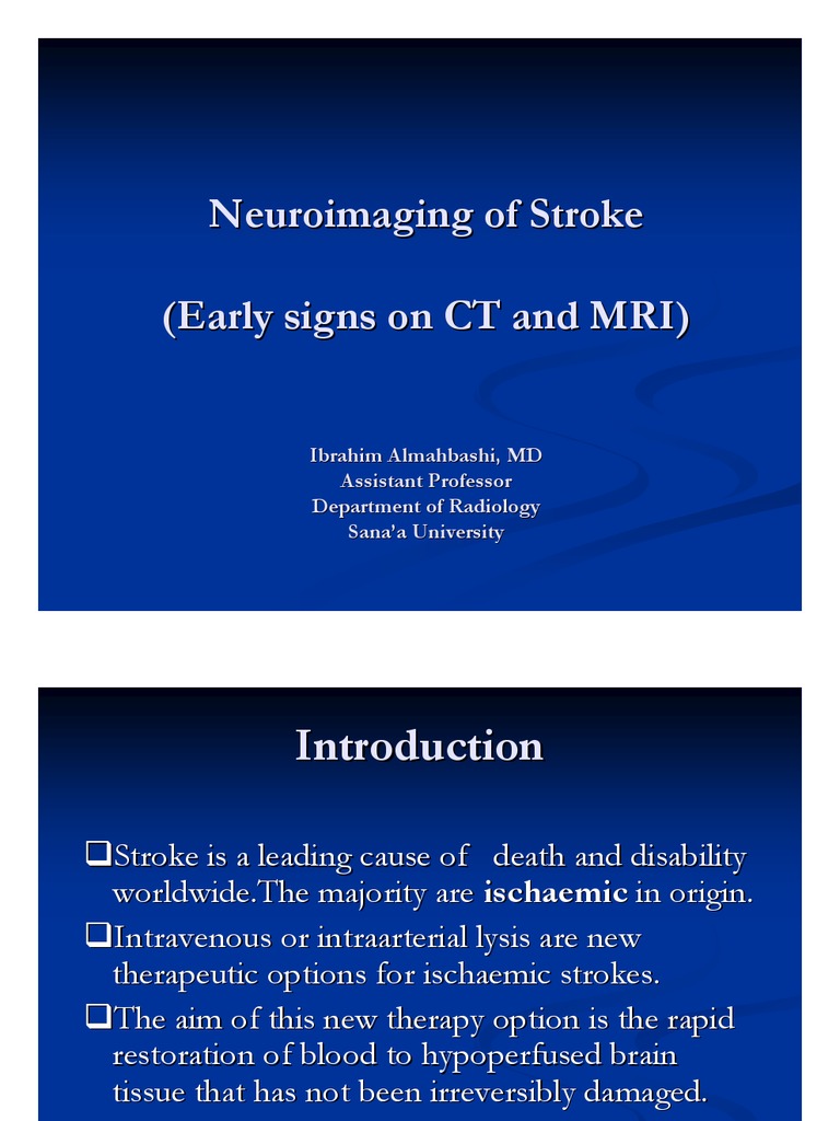 Neuroimaging of Stroke (Early Signs On CT and MRI) | PDF | Stroke ...