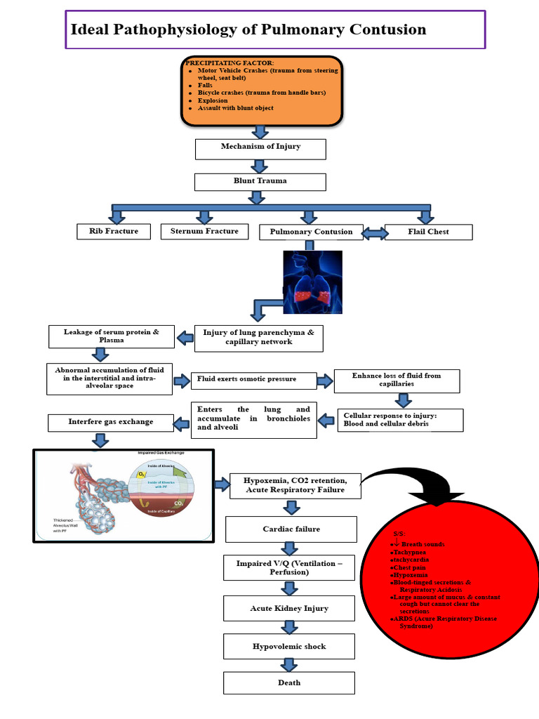 Patho of Pulmonary Contusion | PDF | Lung | Respiratory System