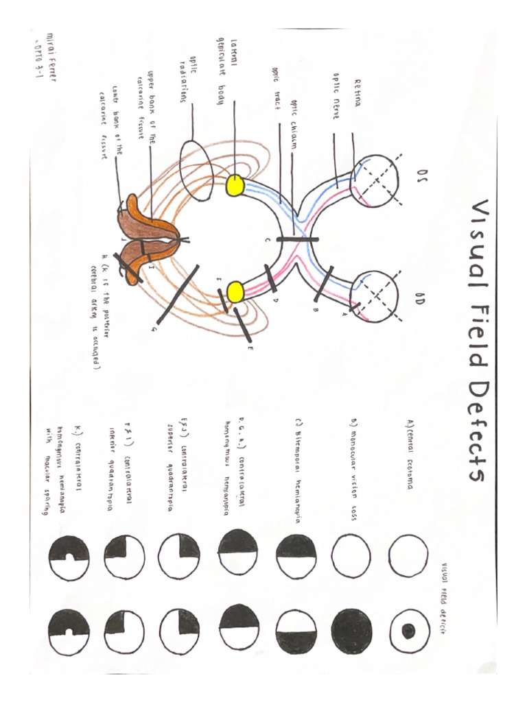 Visual Pathway | PDF