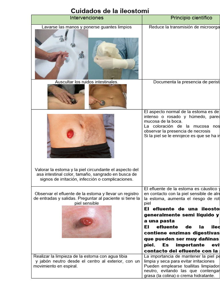 Cuidados Esenciales de la Ileostomía | PDF | Enfermedades y trastornos ...
