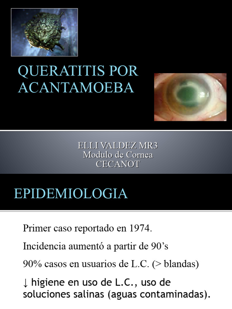 Queratitis Por Acanta Elli | PDF | Corticosteroides | Enfermedades y ...
