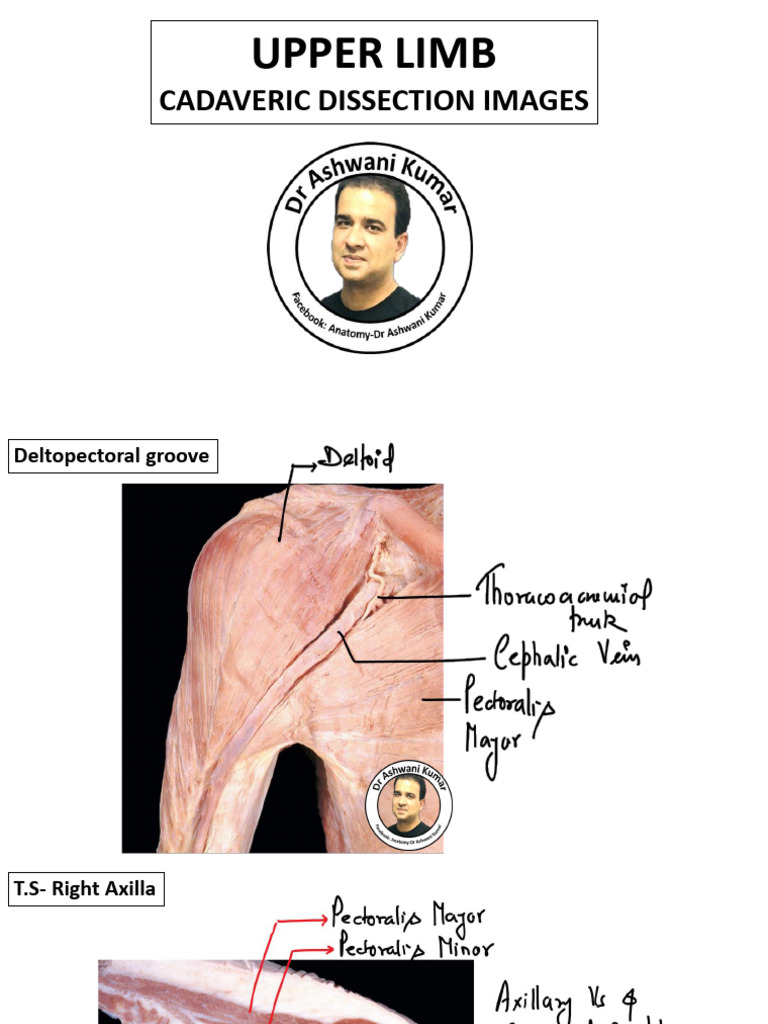 Upper Limb Cadaveric Images Guide | PDF | Human Leg | Anatomy
