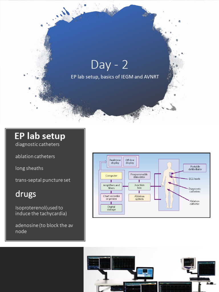 Basics of Ep and Avnrt | PDF | Electrocardiography | Artificial Cardiac ...