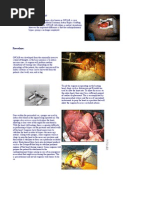 Octopus Evolution | PDF | Coronary Artery Bypass Surgery ...