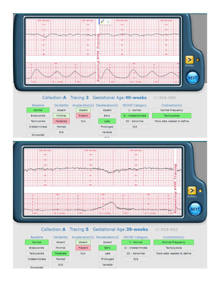 EFM Practice Results | PDF